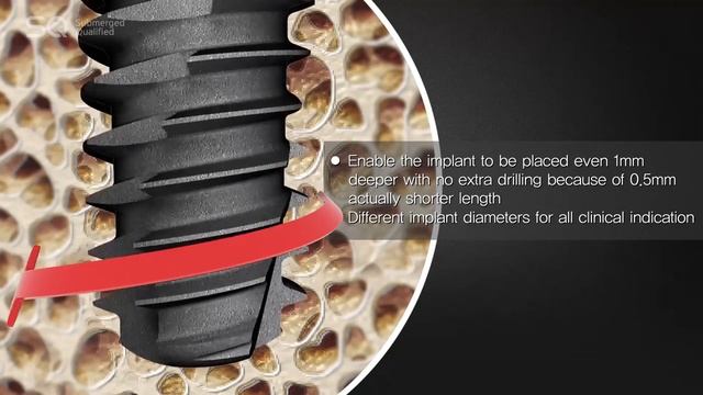 [DENTIS Implant] SQ Implant - Submerged Qualified