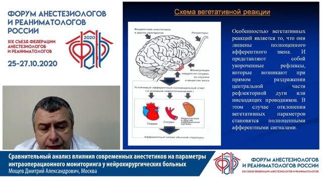 Центрогенные реакции при удалении опухолей ЗЧЯ Назаров РВ  ФАРР 2020