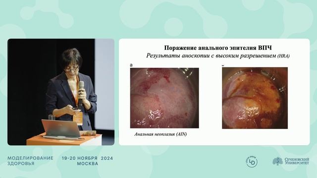 Делать или не делать прививку от ВПЧ?