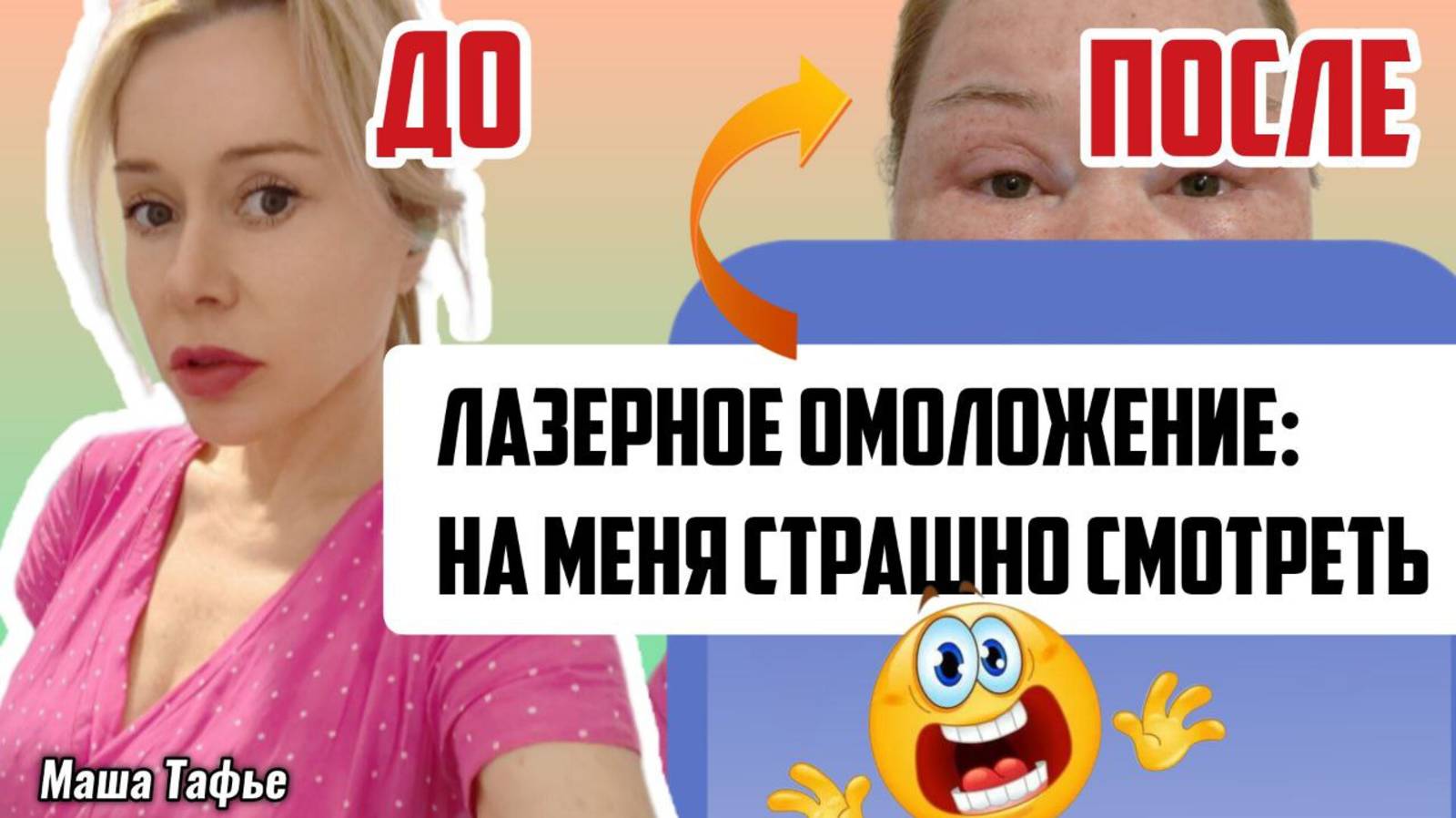 Лазерное омоложение: на меня страшно смотреть. Весна с Машей 🌷 Видео №47