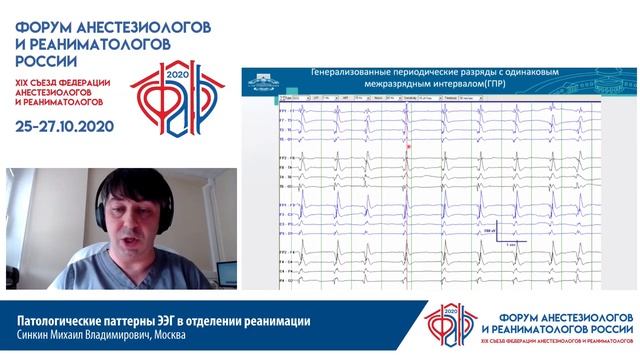 Паттерны ЭЭГ в ОРИТ Синкин МВ  ФАРР 2020