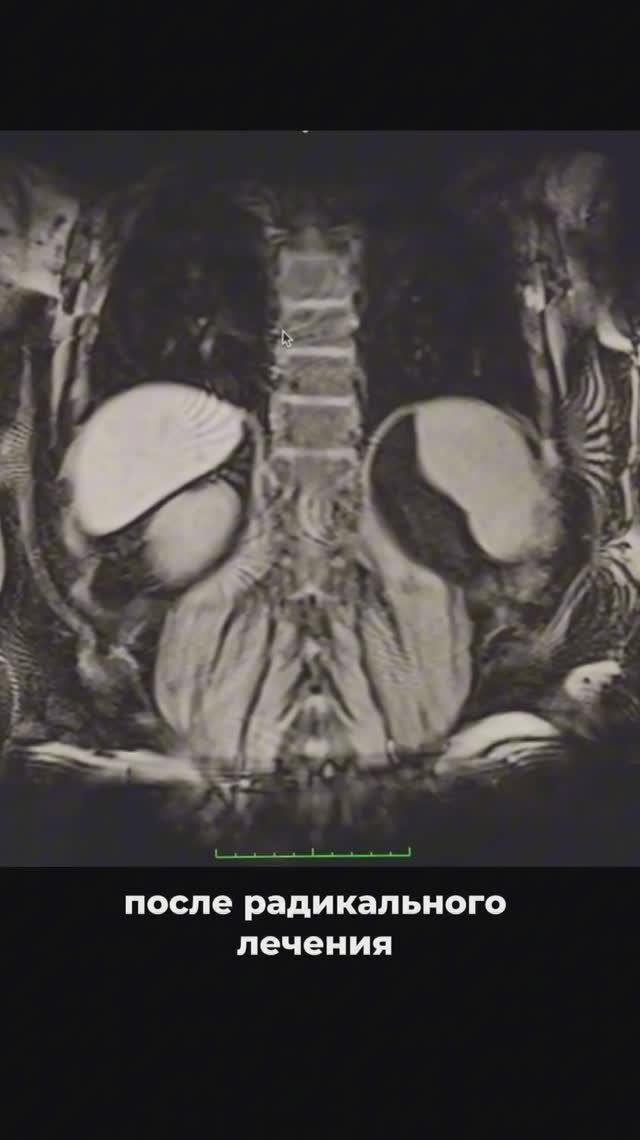 МРТ брюшной полости и забрюшинного пространства