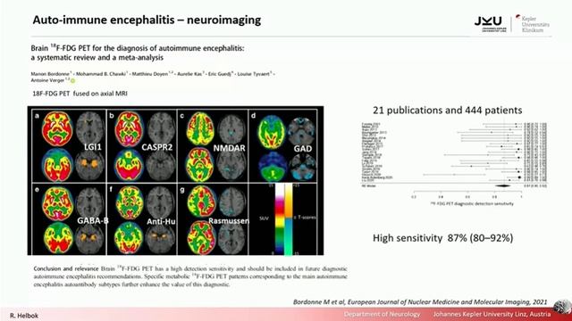 Autoimmune encephalitis  Raimund Helbok ISICEM-44 (2025)