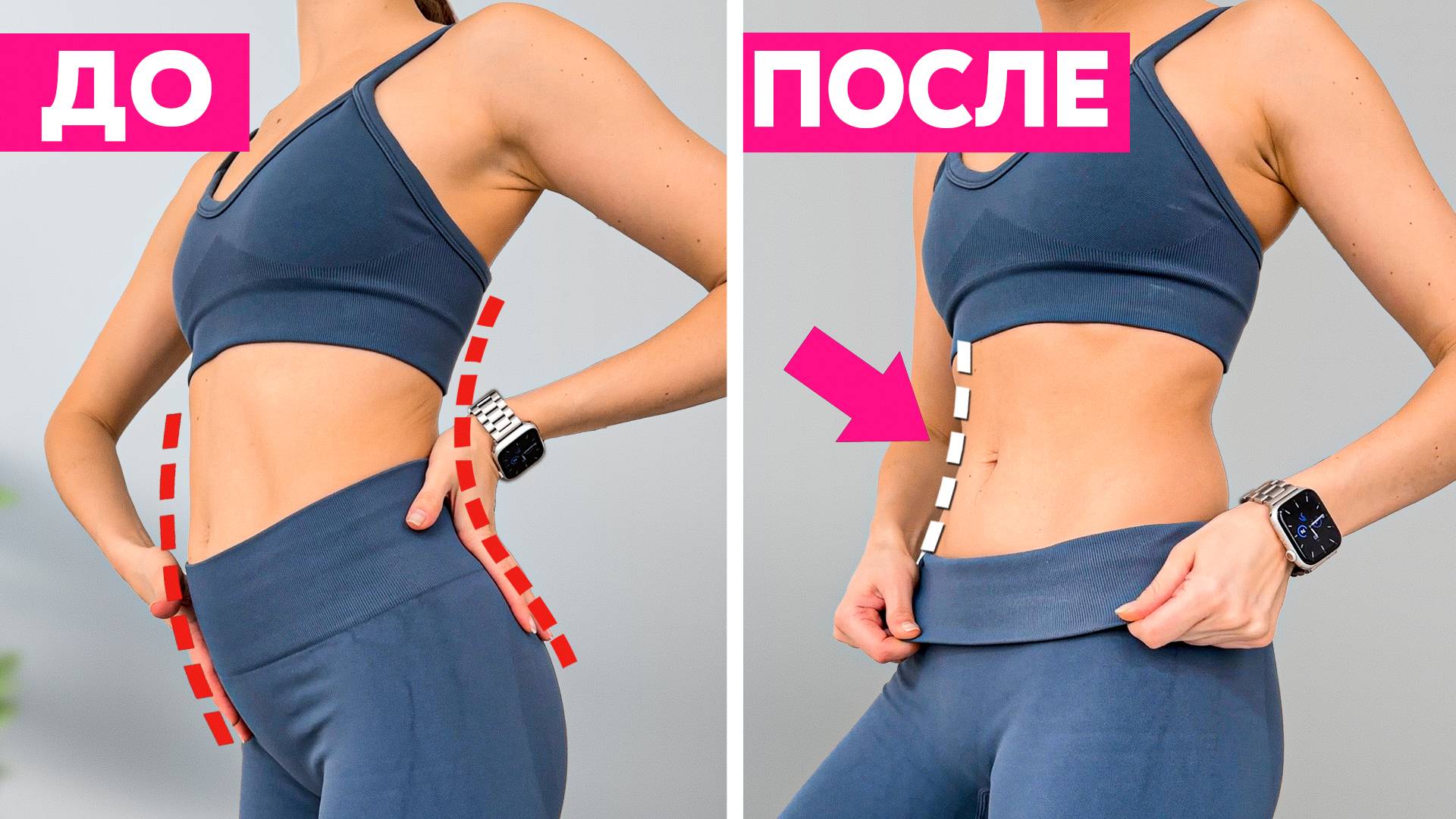 Выпирает живот, гиперлордоз и боль в пояснице? Делай всего ОДНО упражнение