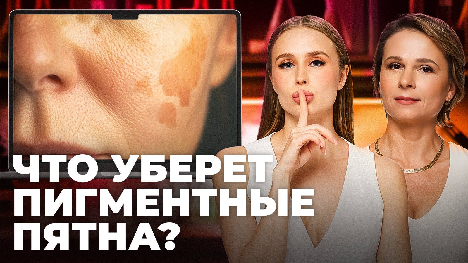 Как убрать морщины и пигментацию — Проверяем советы бьюти-блогеров