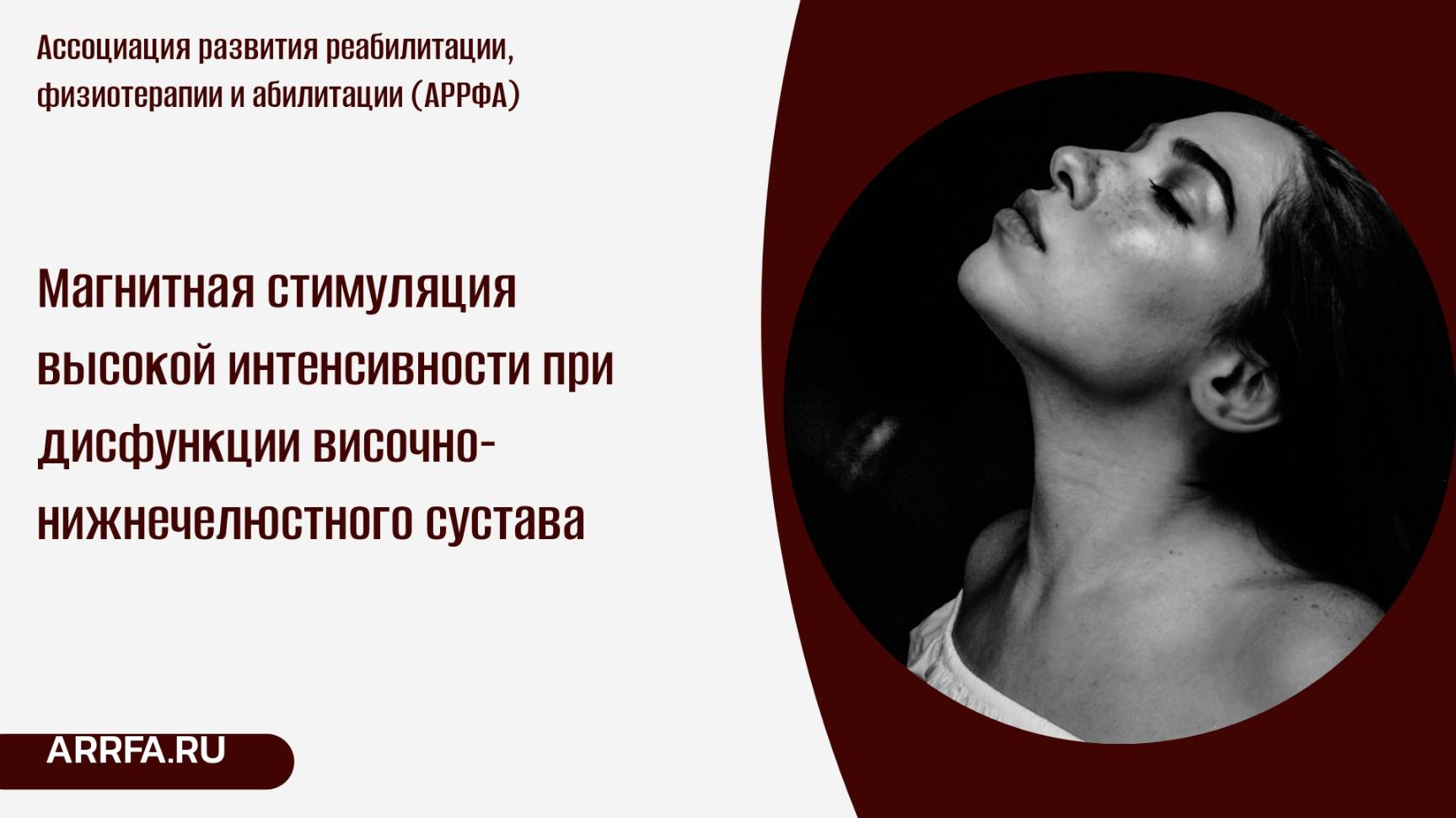 Магнитная стимуляция высокой интенсивности при дисфункции височно-нижнечелюстного сустава