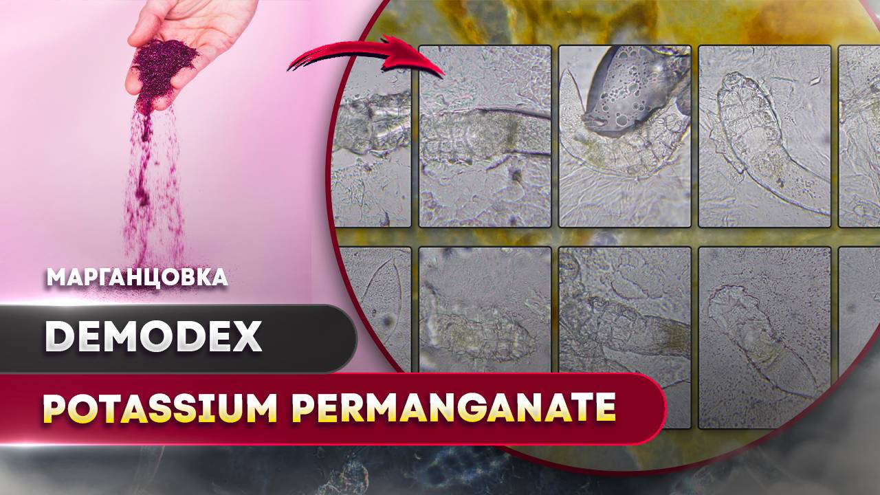 🔥Марганцовка против клеща Демодекс – кто кого? Эксперимент под микроскопом! 🔬💀