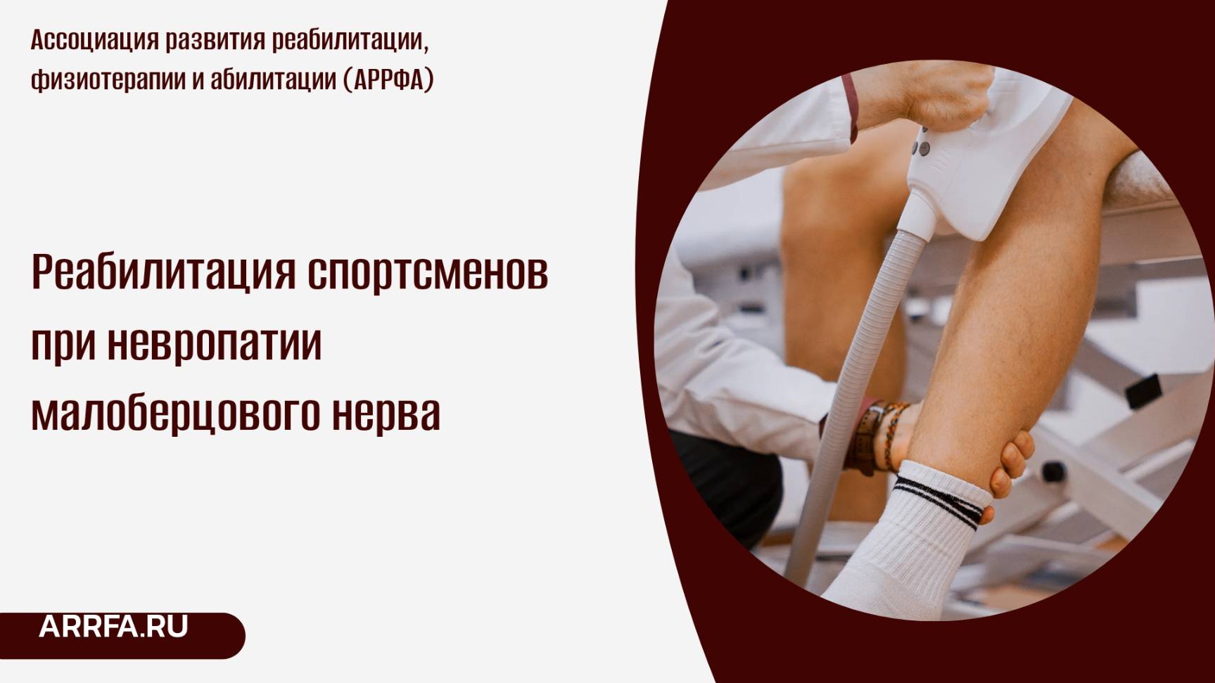 Реабилитация спортсменов при невропатии малоберцового нерва