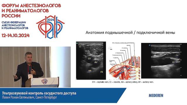 УЗИ - контроль катетеризации + обсуждение Лахин Р.Е. ФАРР 2024