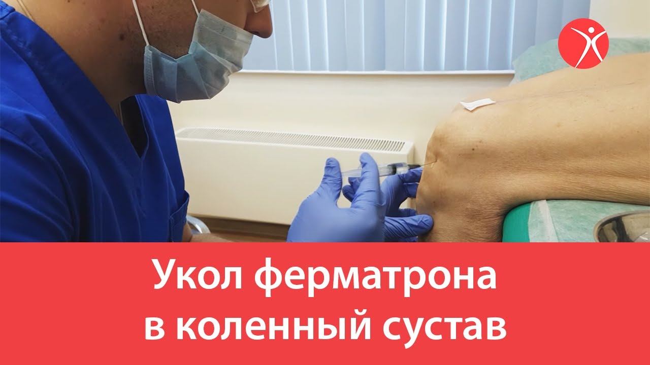 Укол ферматрона в коленный сустав