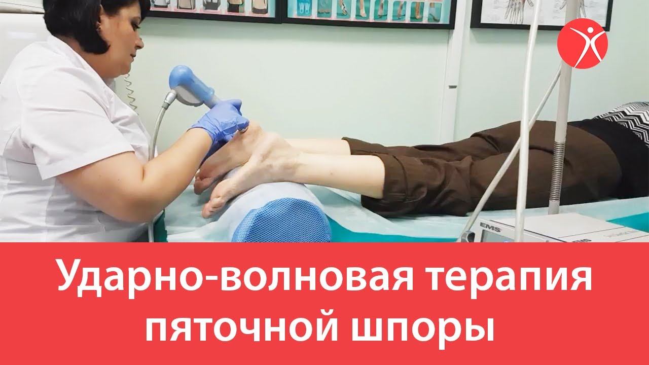 Лечение пяточной шпоры на аппарате ударно-волновой терапией