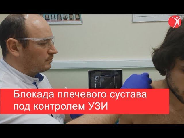 Блокада плечевого сустава под контролем УЗИ