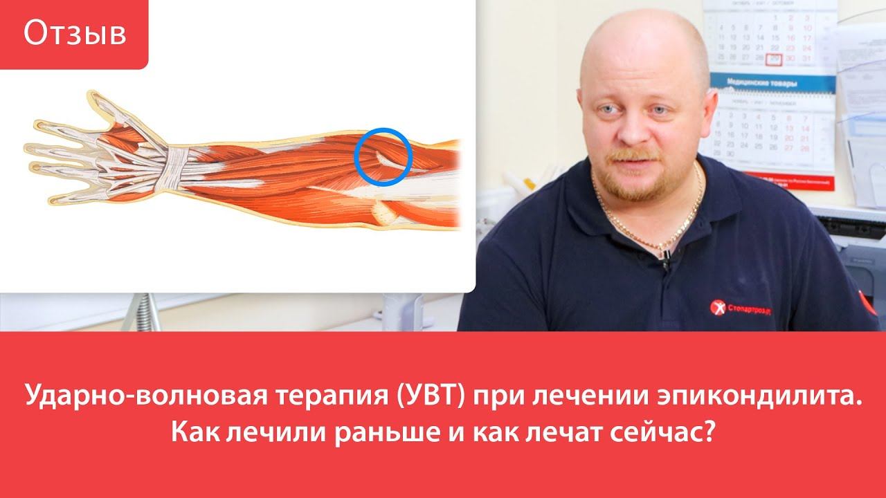 Ударно-волновая терапия (УВТ) при лечении эпикондилита. Как лечили раньше и как лечат сейчас?