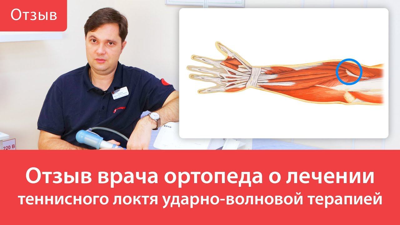 Отзыв врача ортопеда о лечении теннисного локтя ударно-волновой терапией