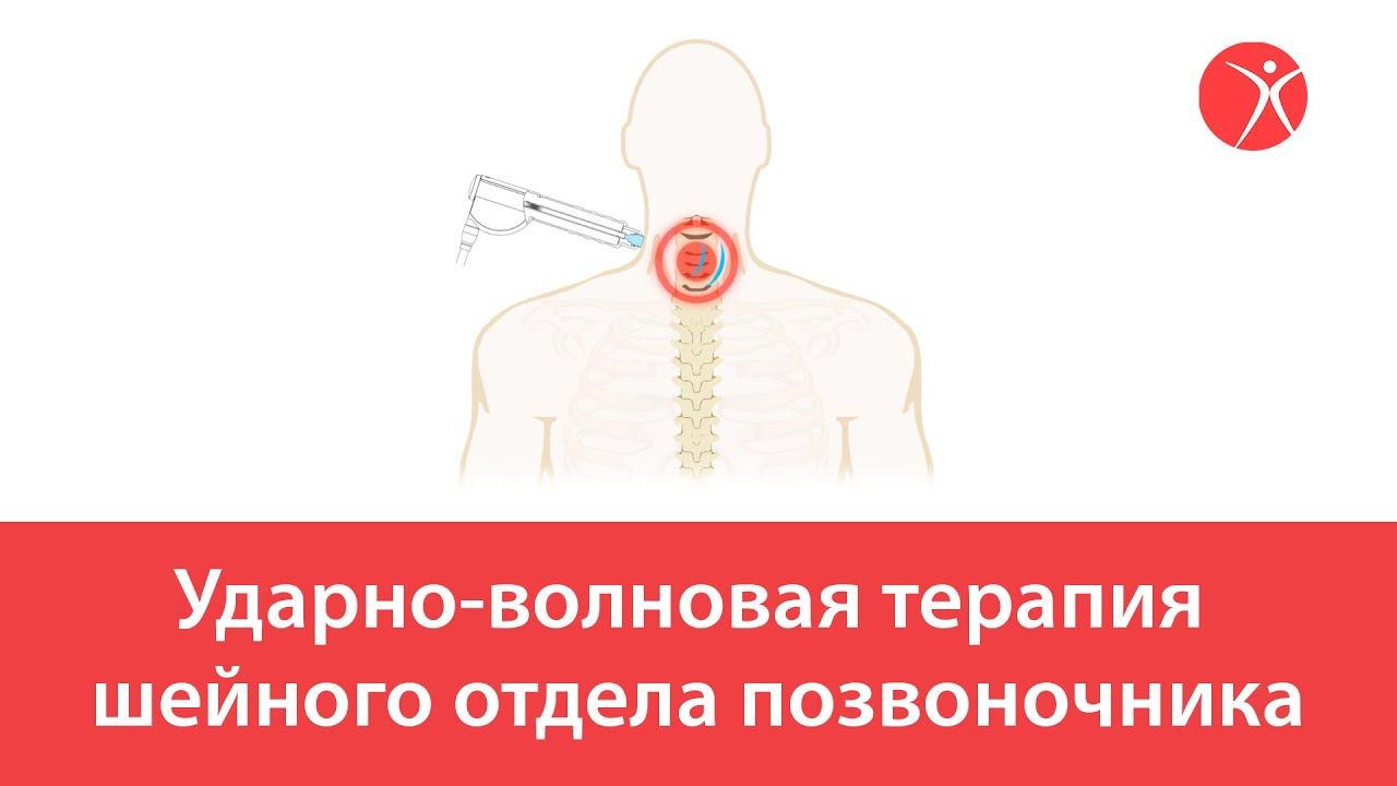 Ударно-волновая терапия шейного отдела позвоночника