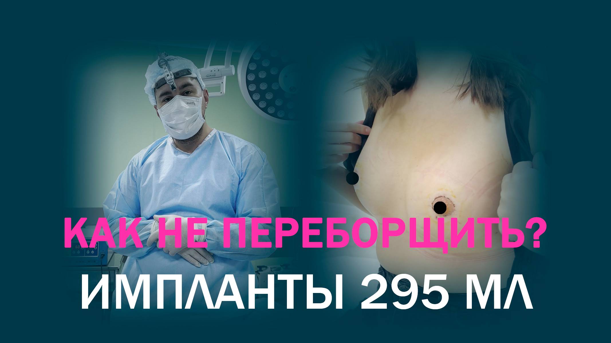 Увеличение груди без перебора: 295 мл для естественного результата