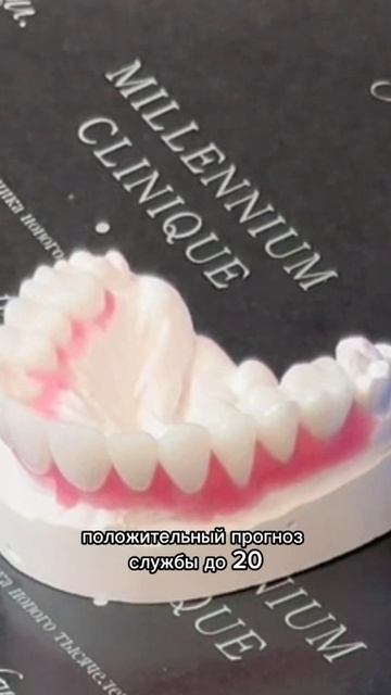 Срок службы керамических накладок