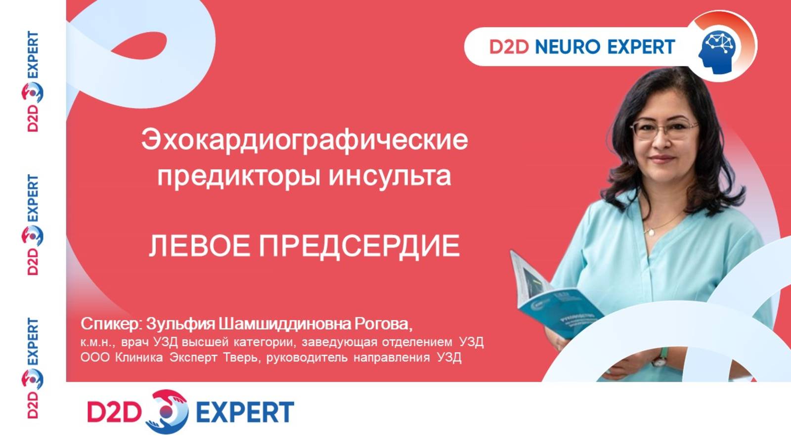 Эхокардиографические предикторы инсульта: левое предсердие