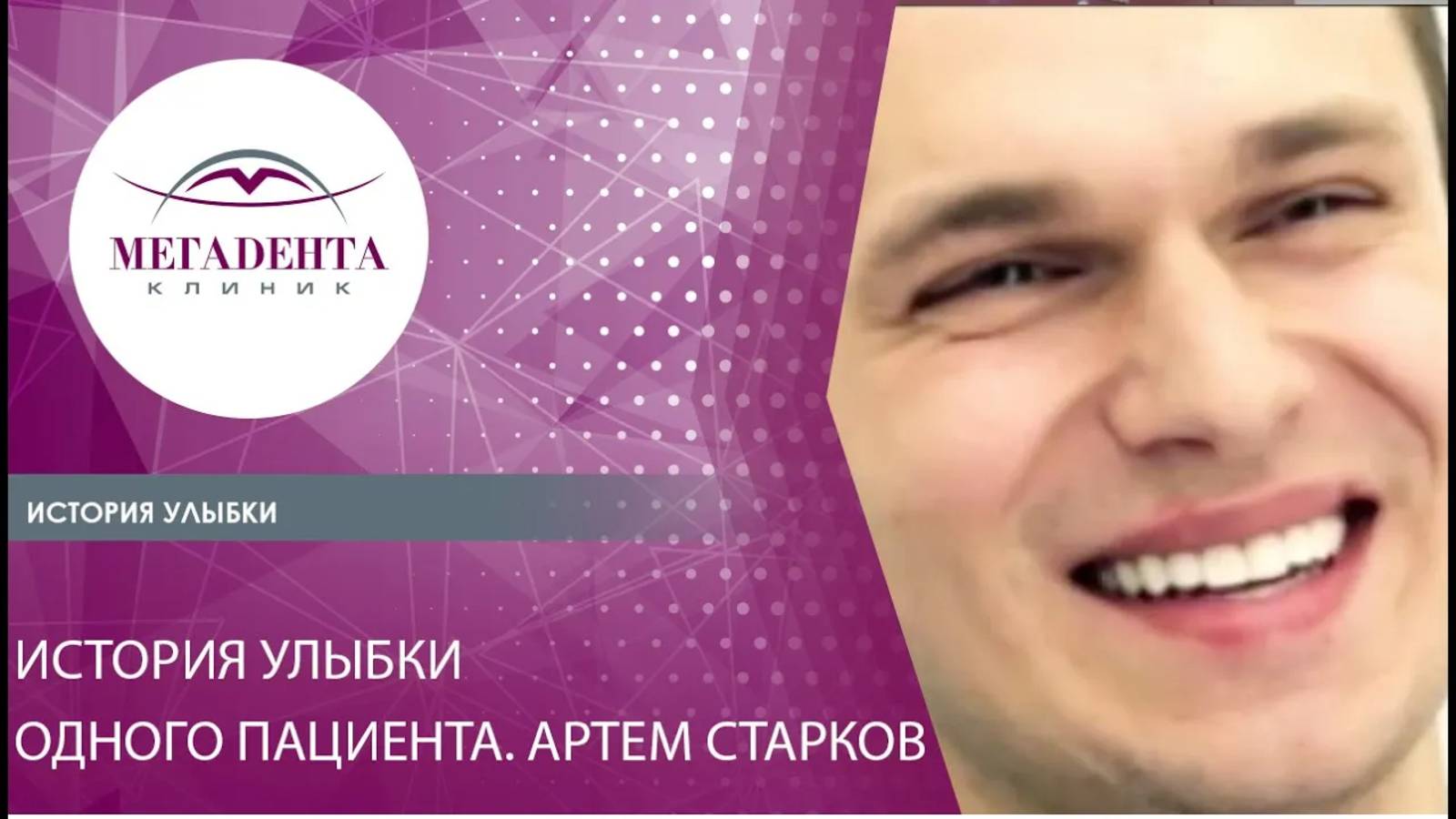 История улыбки одного пациента. Артем Старков
