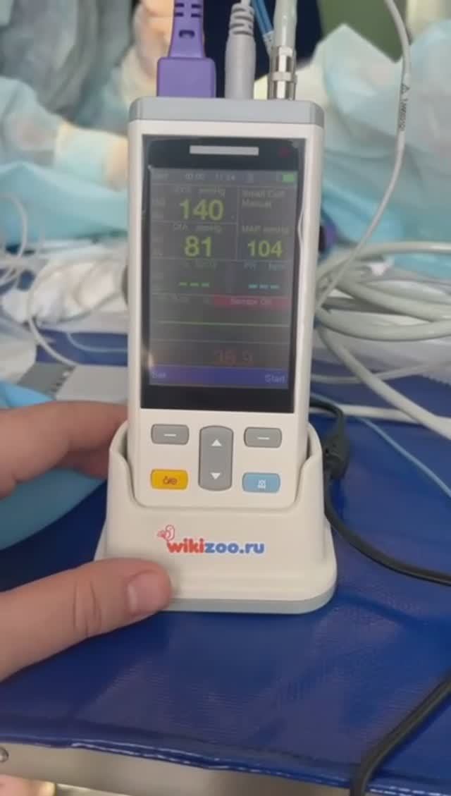 Портативный монитор пациента, тест
