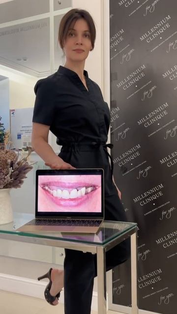 Преображение улыбки