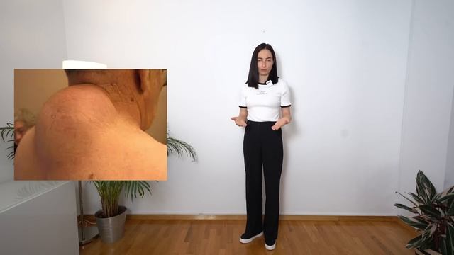 Чем опасна ХОЛКА НА ШЕЕ и как её УБРАТЬ_ Причины возникновения горбика на шее, которые ВАЖНО знать