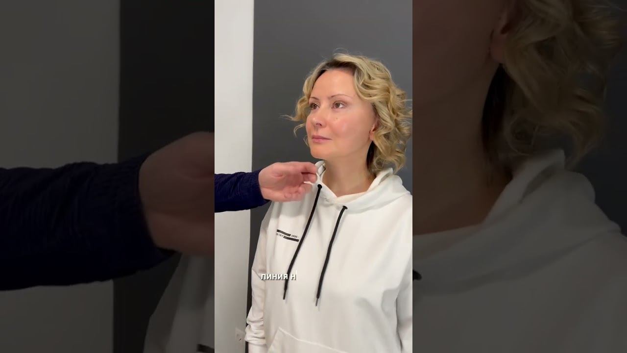 #smas-лифтинг