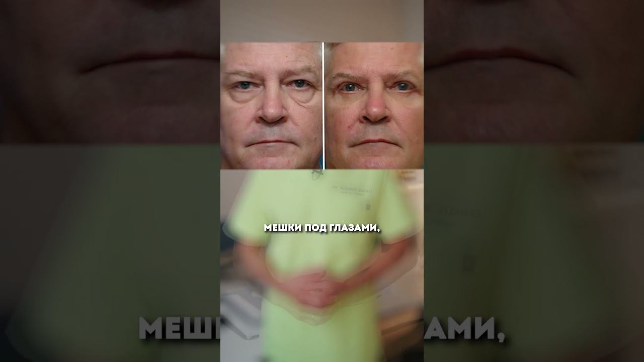 Топ-3 популярных операций у мужчин