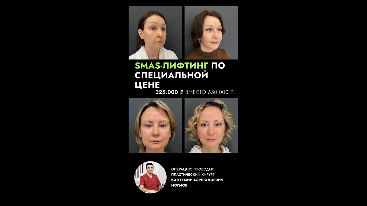 #SMASлифтинг — минус 50%