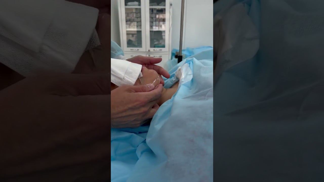 #Липомоделирование овала лица