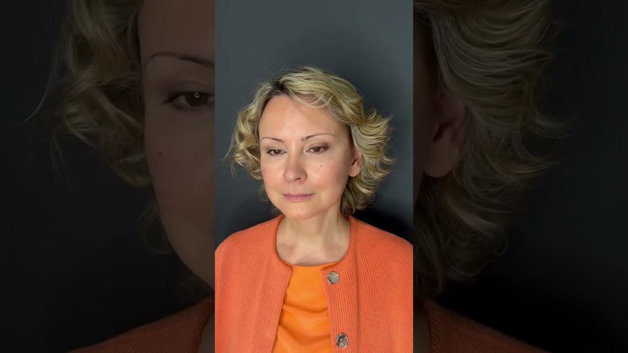 #smas-пластика лица и шеи: через 3 месяца