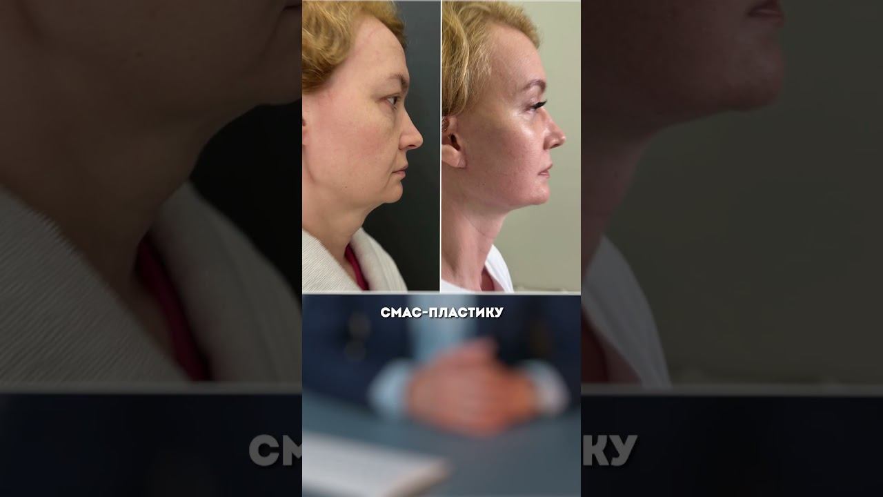 Топ-3 самых дорогих операций