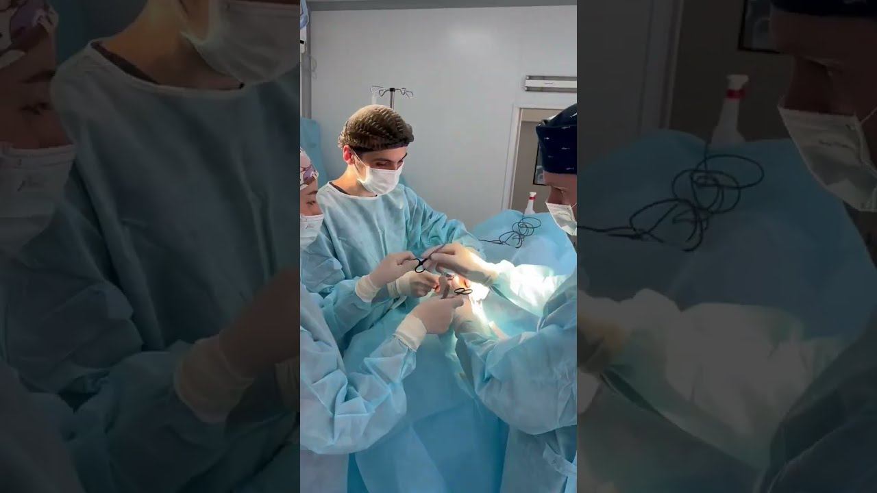 Верхняя блефаропластика: процесс #блефаропластика #блефаропластикамосква