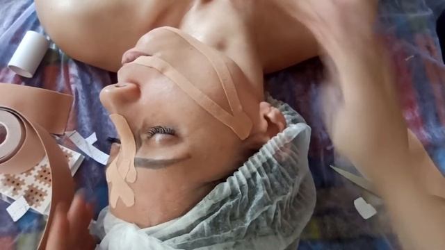 тейпирование лица