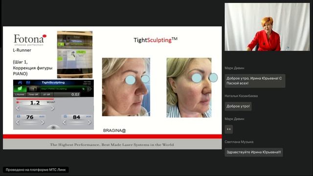 Вебинар 21.04.25. Протоколы Fotona "лицо под ключ" для пациентов 55+ лет