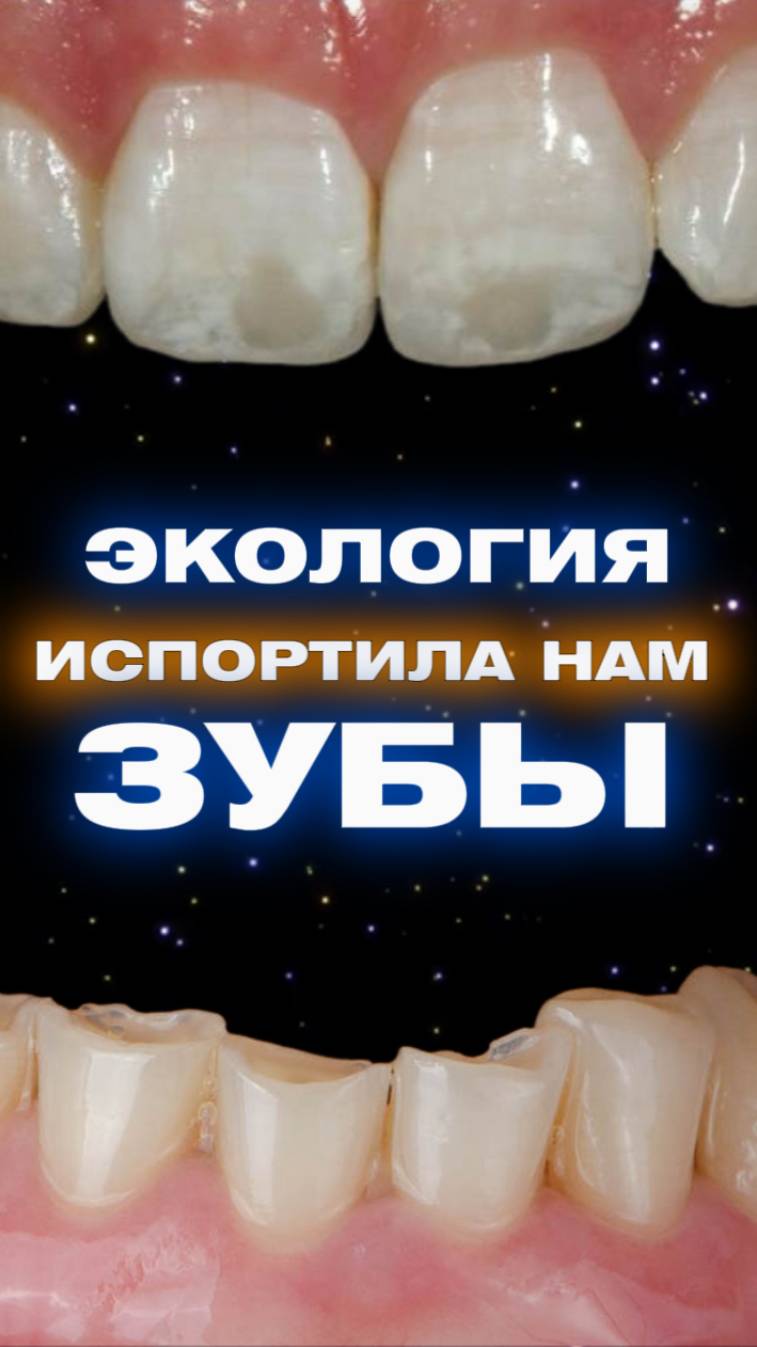 ФЛЮОРОЗ И ЭКОЛОГИЯ. КАКАЯ МЕЖДУ НИМИ СВЯЗЬ?