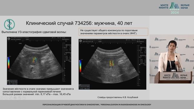 МР-эластография: первый опыт применения и перспективы | #WNOF2024