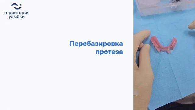 Перебазировка протеза