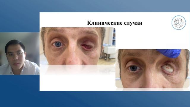 Лига молодых офтальмологов