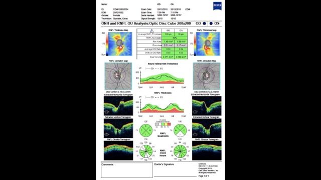 Интерпретация отчетов ОКТ дисков зрительных нервов - Панфилова А.Н