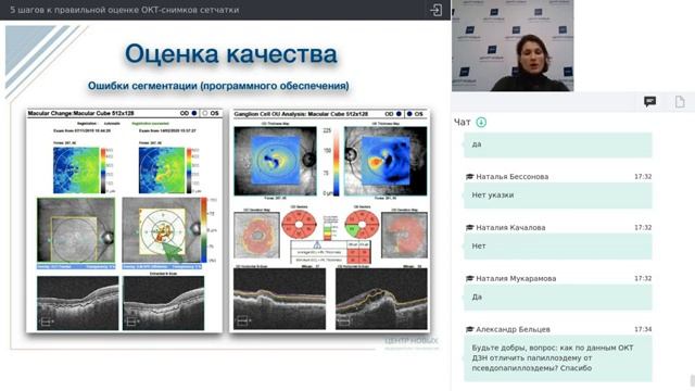 Вебинар по оценке ОКТ-снимков сетчатки. Панфилова А.Н