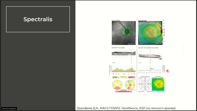 Анализ макулярной зоны и внутренних слоев сетчатки при глаукоме. Архитектоника с