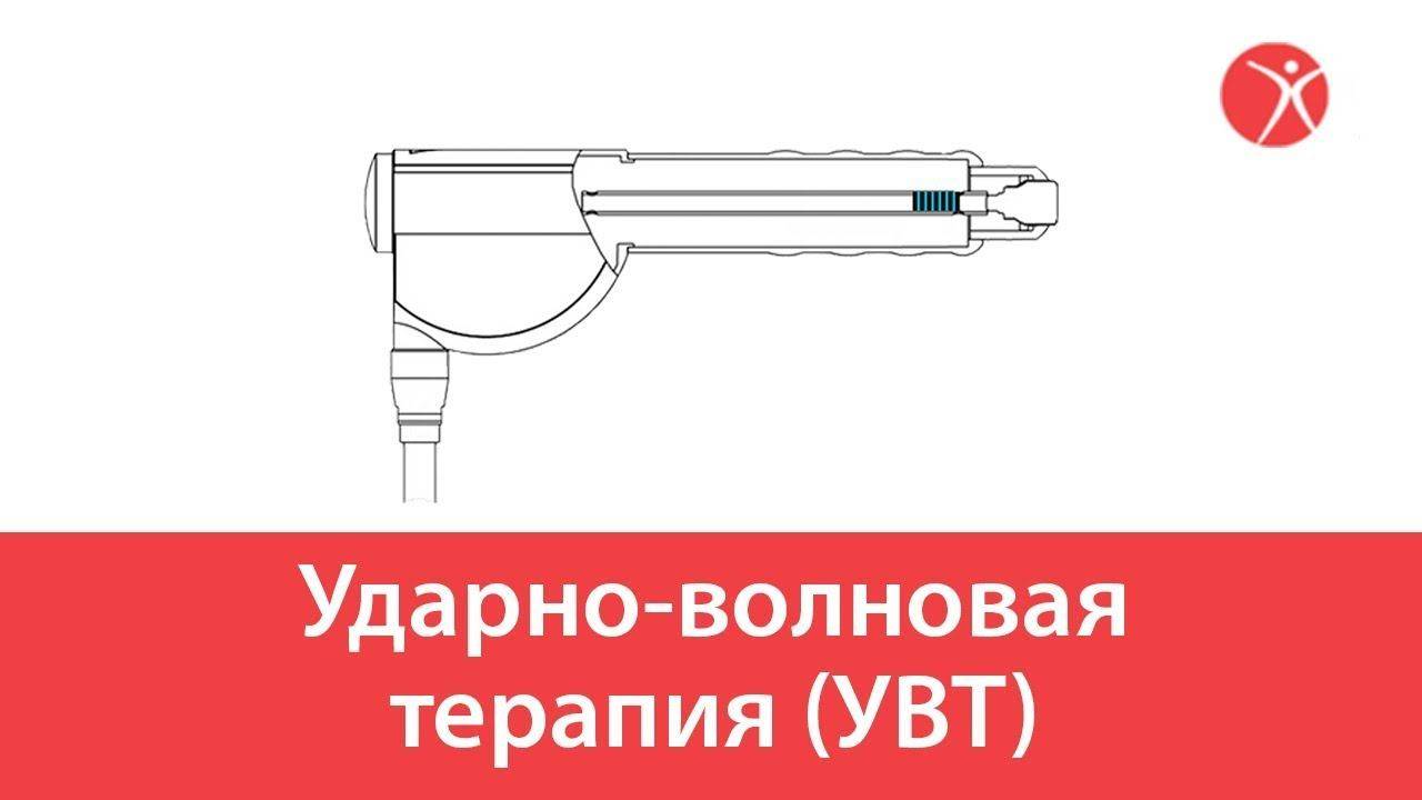 Ударно-волновая терапия (УВТ) в клинике Стопартроз