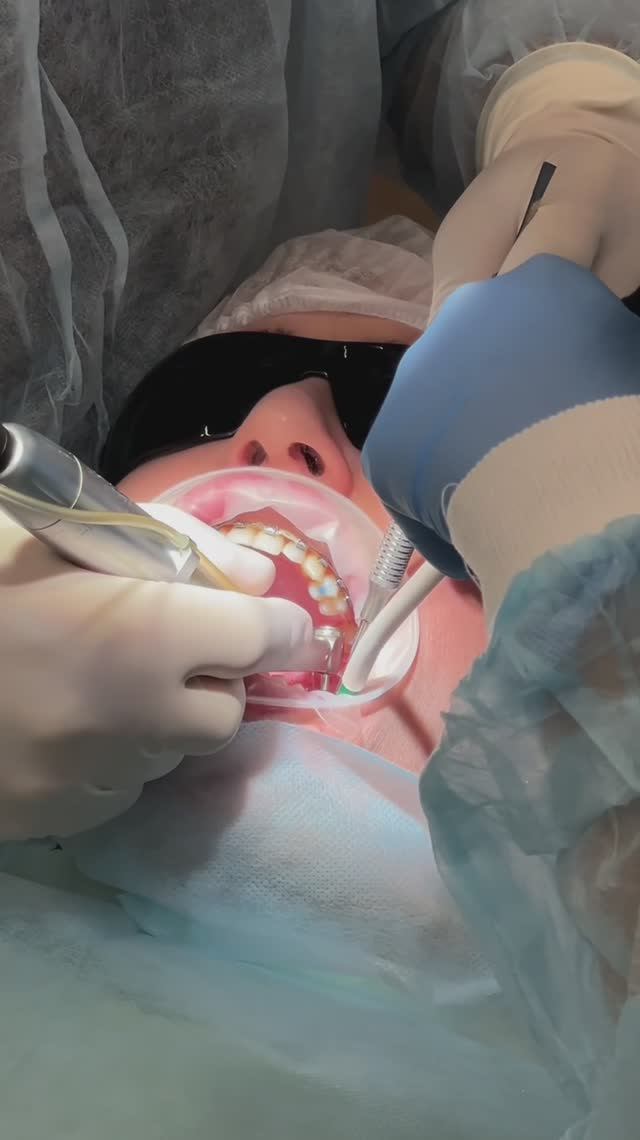 Процесс имплантации. Врач: Харин Александр Александрович - стоматолог-хирург, ортопед, имплантолог