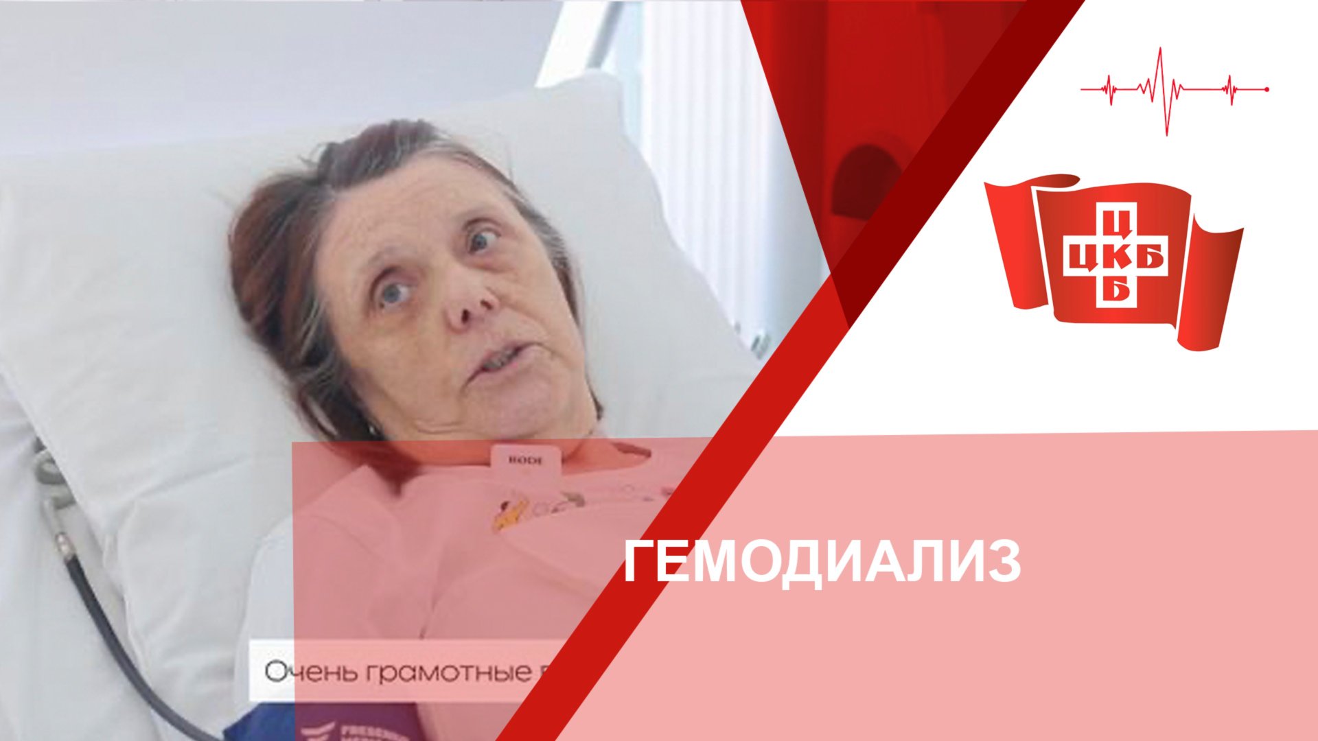 Гемодиализ