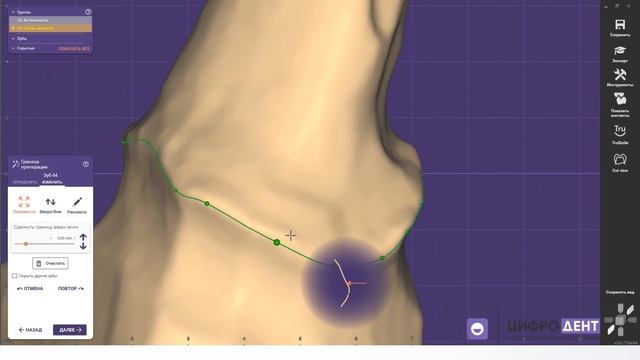 Сканирование и моделирование циркониевого каркаса под нанесение