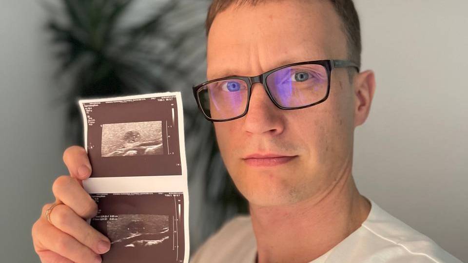 УЗИ щитовидной железы. Как описать узел и какой TIRADS ?