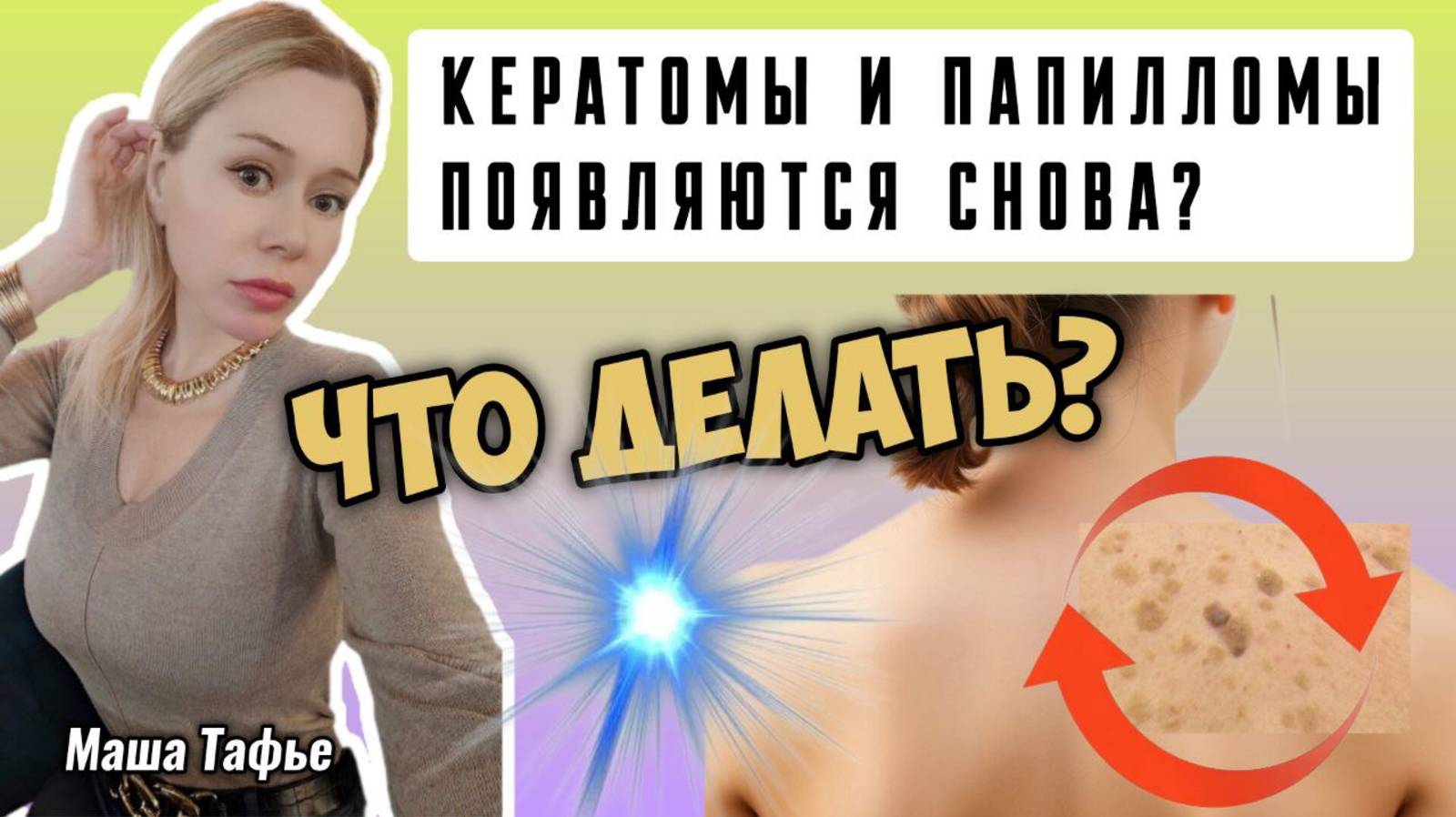 Если кератомы и папилломы появляются вновь. Что делать? Весна с Машей 🌷 Видео №66