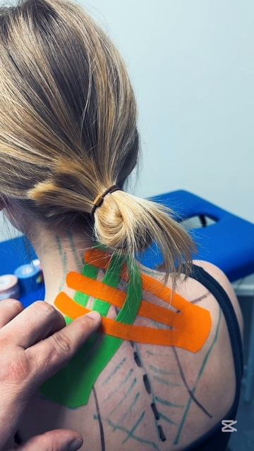 тейпирование для улучшения притока крови к голове