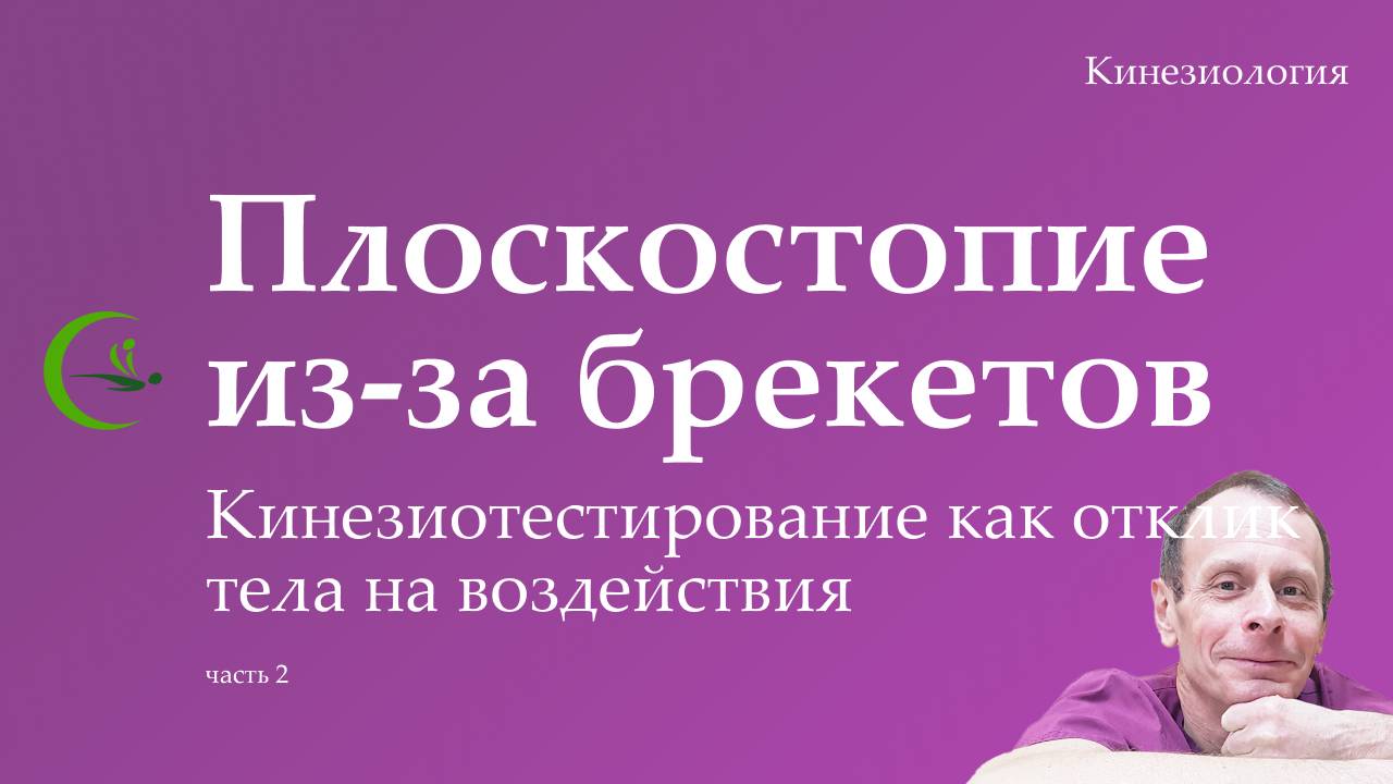 Плоскостопие из-за брекетов. Часть 2